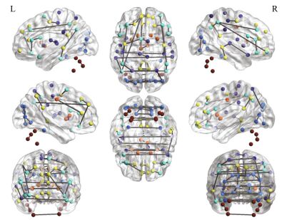 Inferring Functional Connectivity in fMRI Using Minimum Partial Correlation