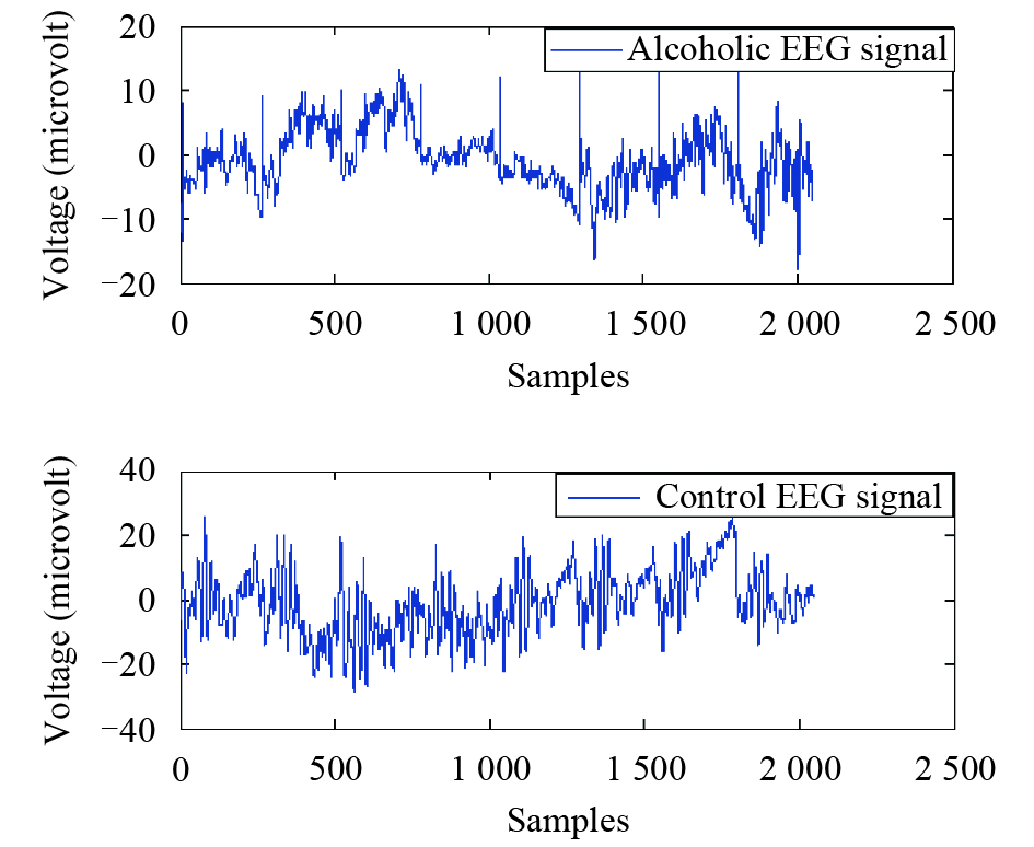 An Advanced Analysis System for Identifying Alcoholic Brain State ...
