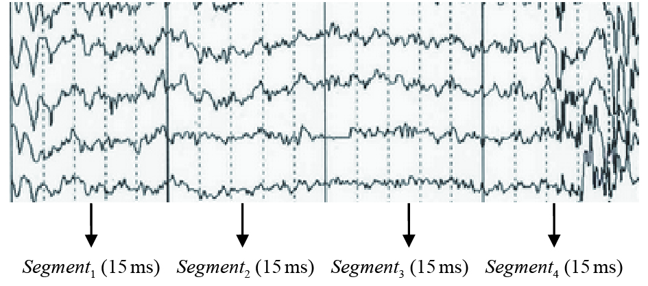 An Advanced Analysis System for Identifying Alcoholic Brain State ...