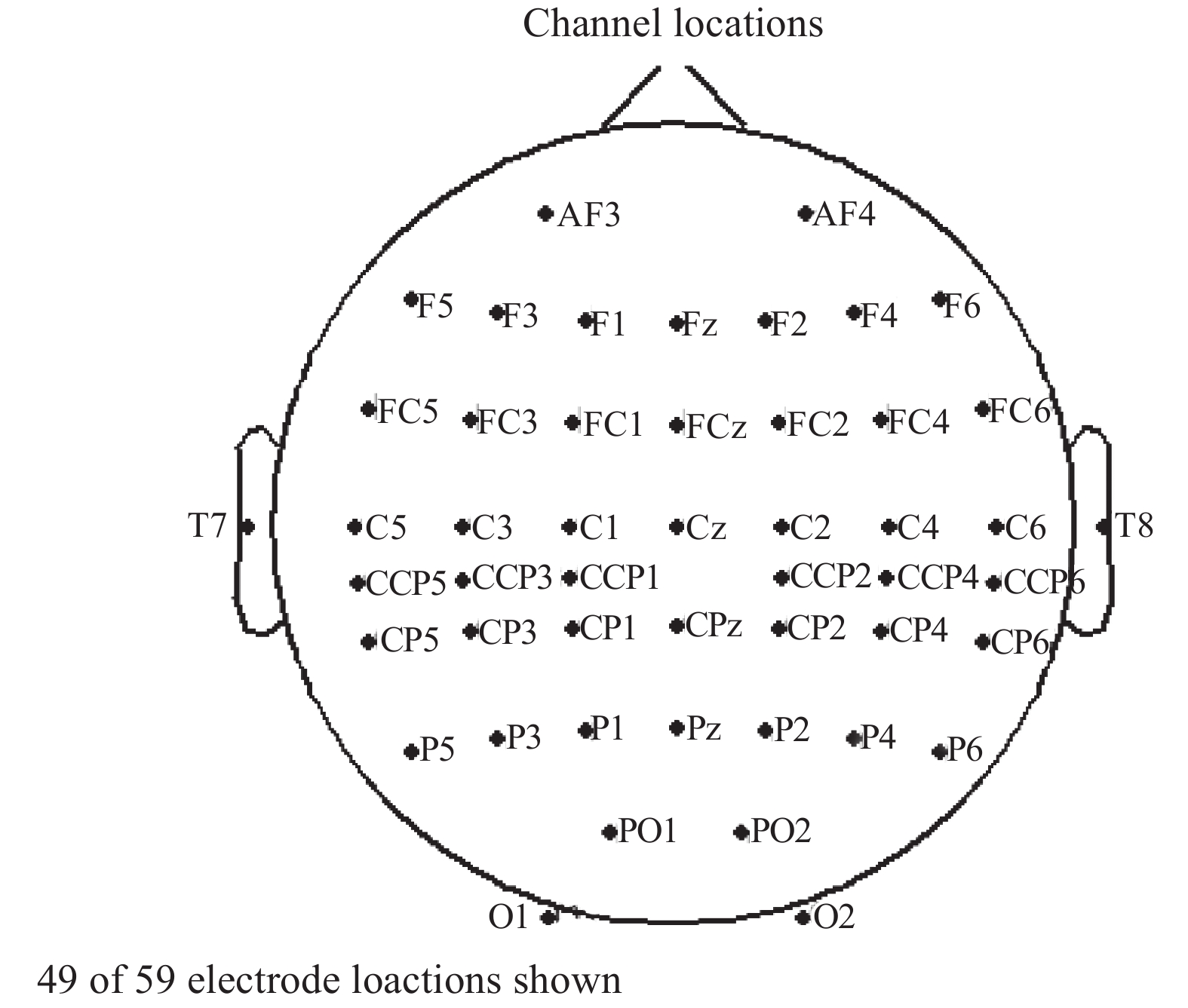 Accurate Classification of EEG Signals Using Neural Networks Trained by ...
