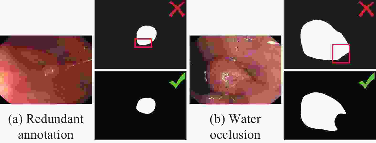 Video Polyp Segmentation: A Deep Learning Perspective