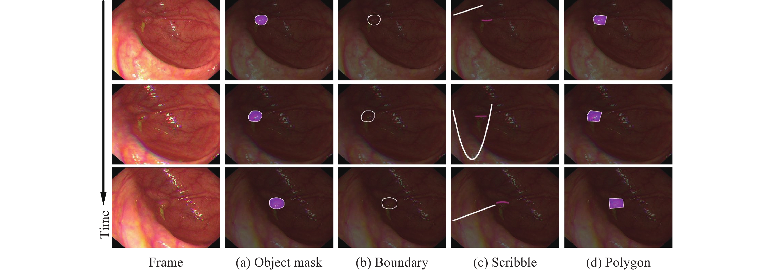 Video Polyp Segmentation: A Deep Learning Perspective