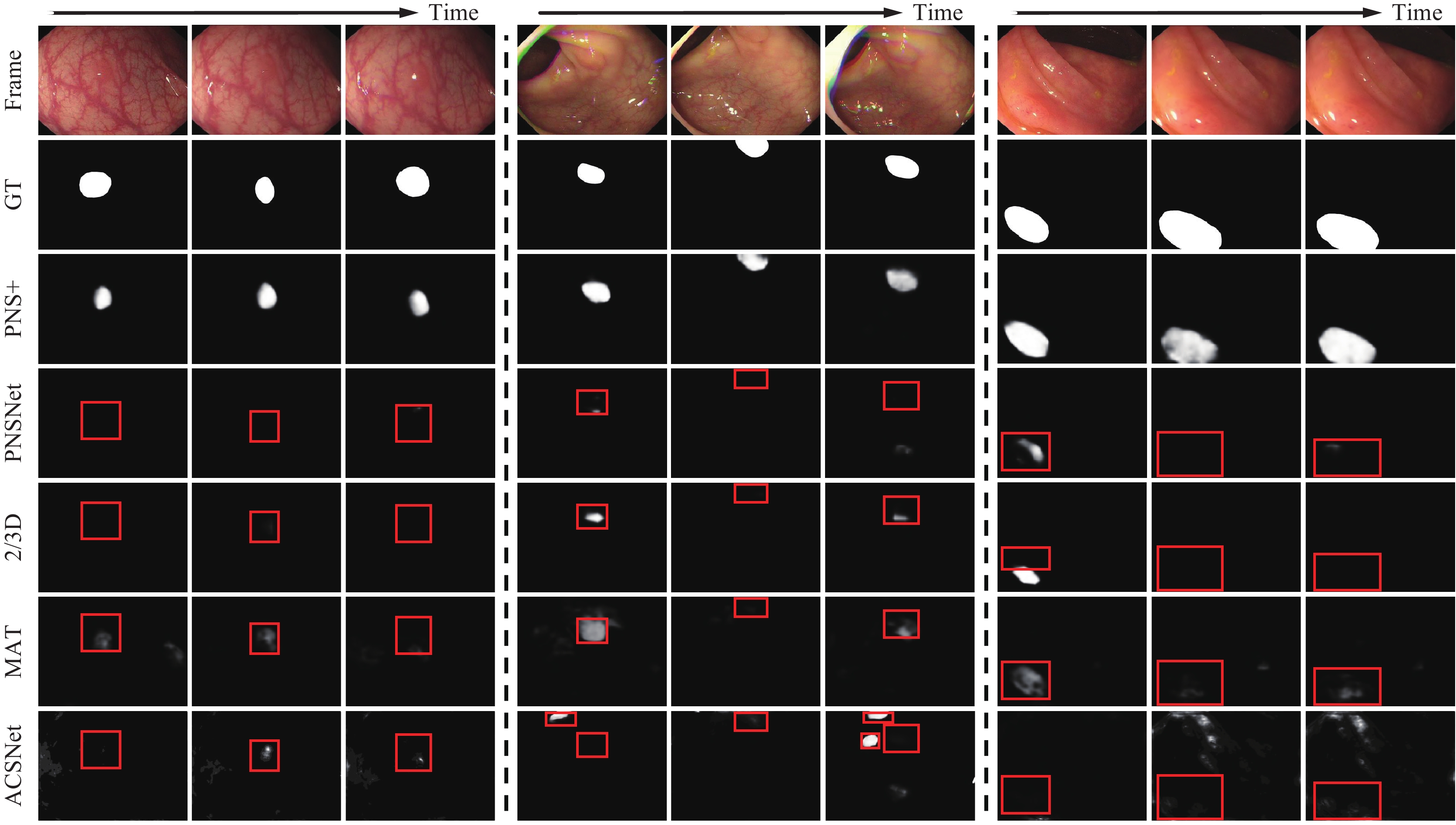 Video Polyp Segmentation: A Deep Learning Perspective