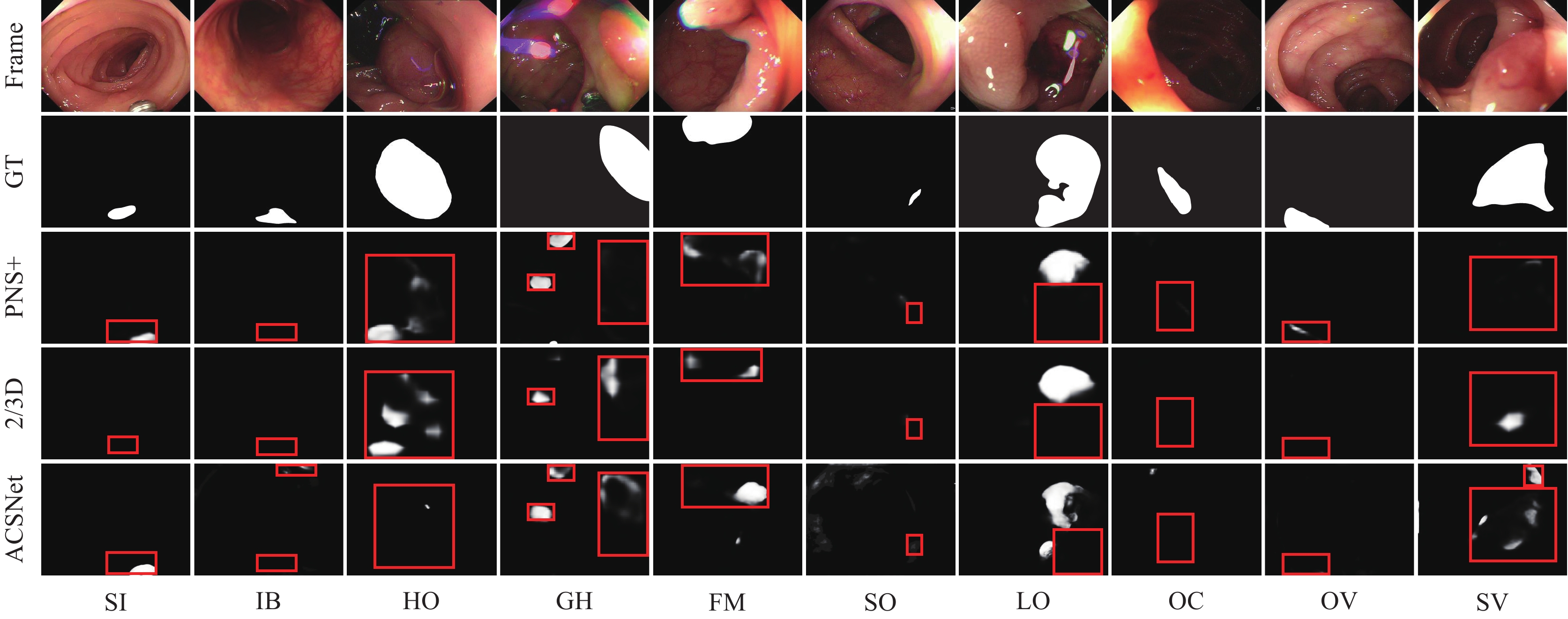 Video Polyp Segmentation: A Deep Learning Perspective
